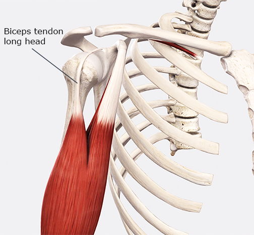 An Inside Look at Bicipital Tendinopathy - Academy of Clinical Massage